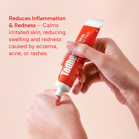 Herbal Skin Repair Cream – Fast Healing & Nourishment – Tadheen